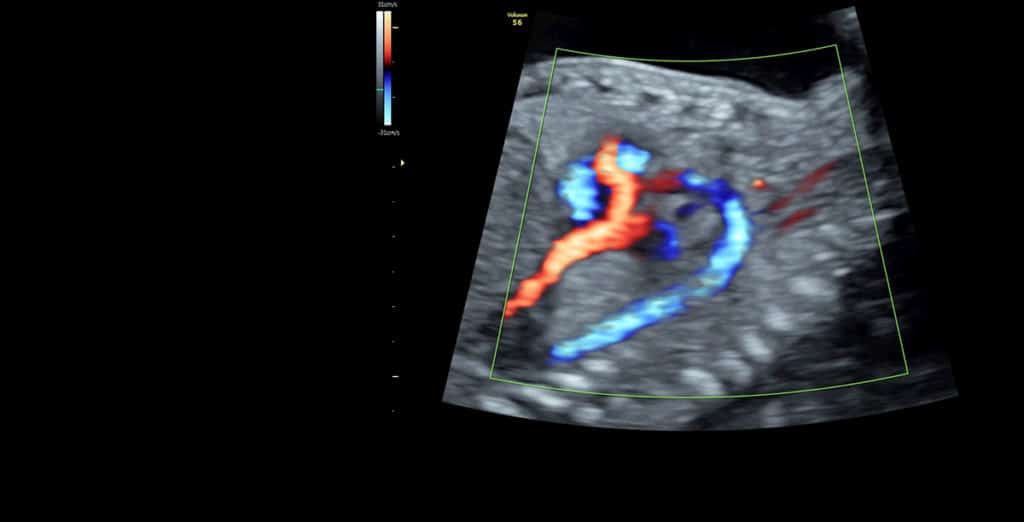 USG-doppler żył i tętnic - Gdańska Klinika Flebologii